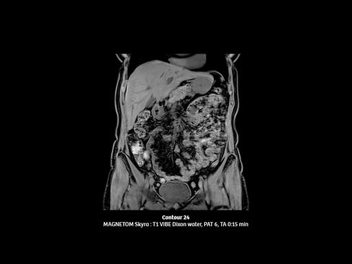 Contour - Siemens Healthineers USA