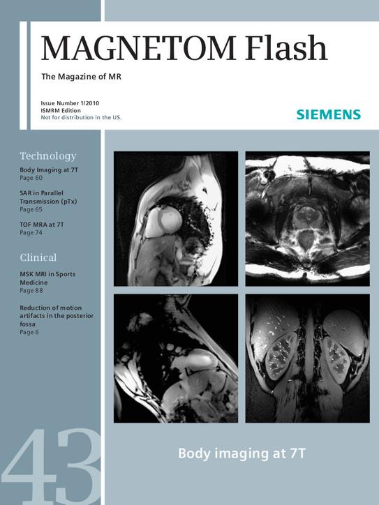 MAGNETOM Flash