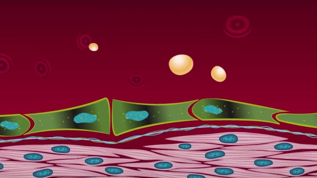 World Thrombosis Day Siemens Healthineers Italia