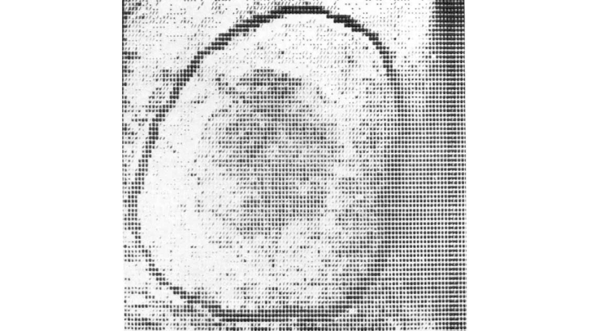 History of computer-aided detection (CAD) - Siemens Healthineers