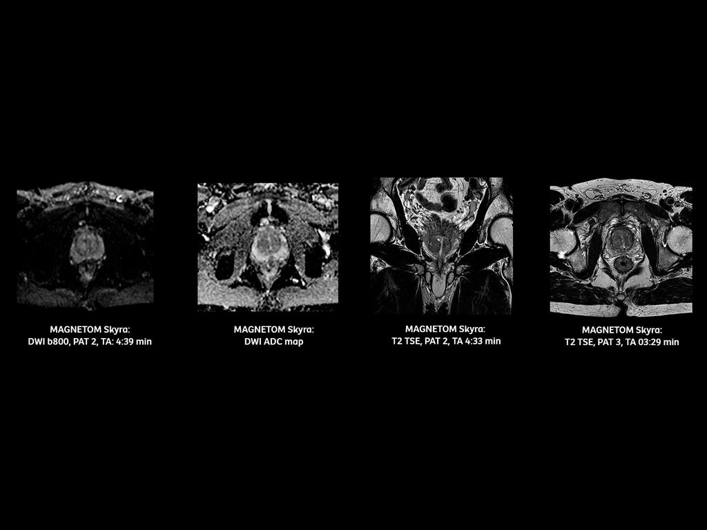 Contour - Siemens Healthineers USA