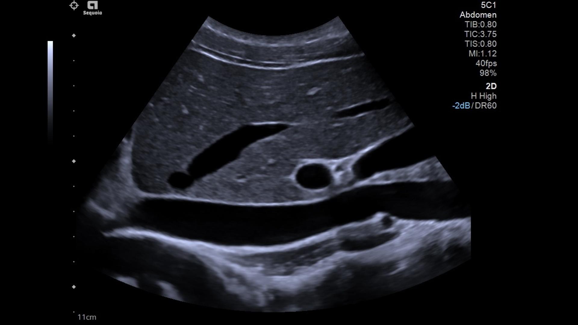 ACUSON Sequoia Ultrasound System - Siemens Healthineers Canada