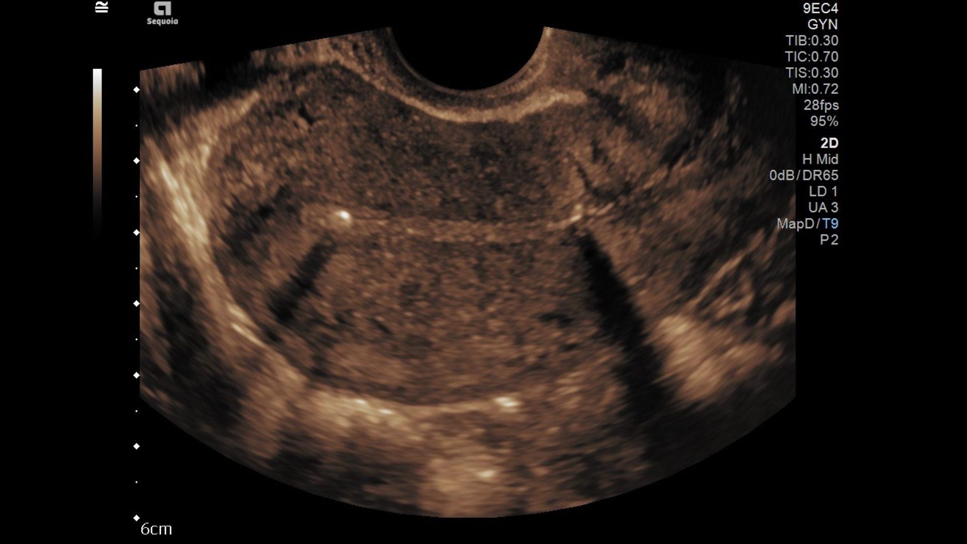 ACUSON Sequoia Ultrasound System - Siemens Healthineers Canada