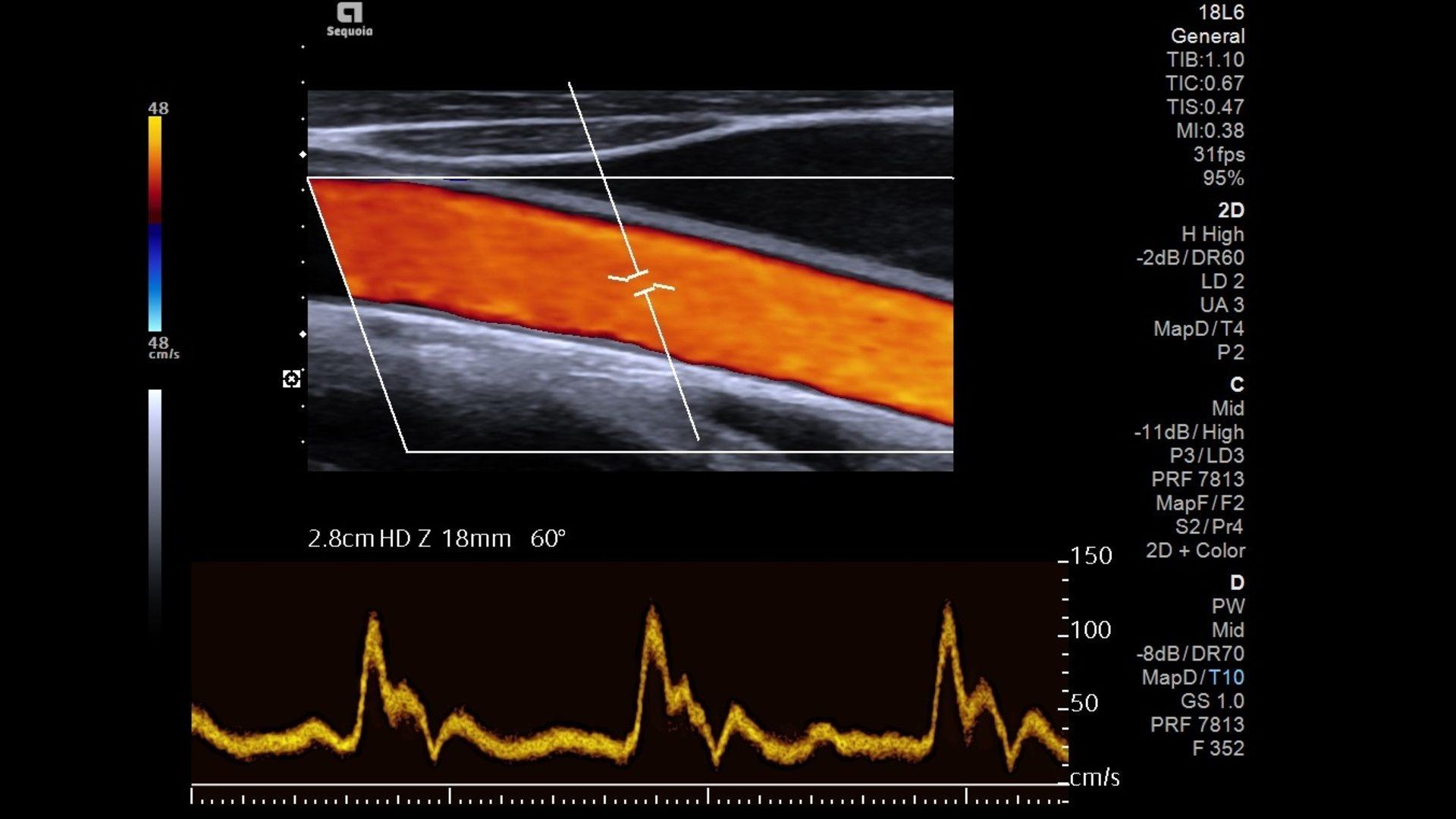 ACUSON Sequoia Ultrasound System - Siemens Healthineers Canada