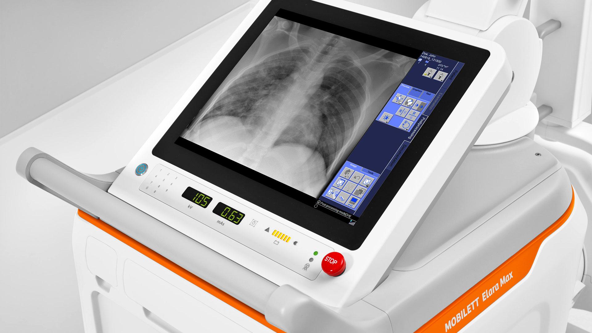 MOBILETT Elara Max - Siemens Healthineers