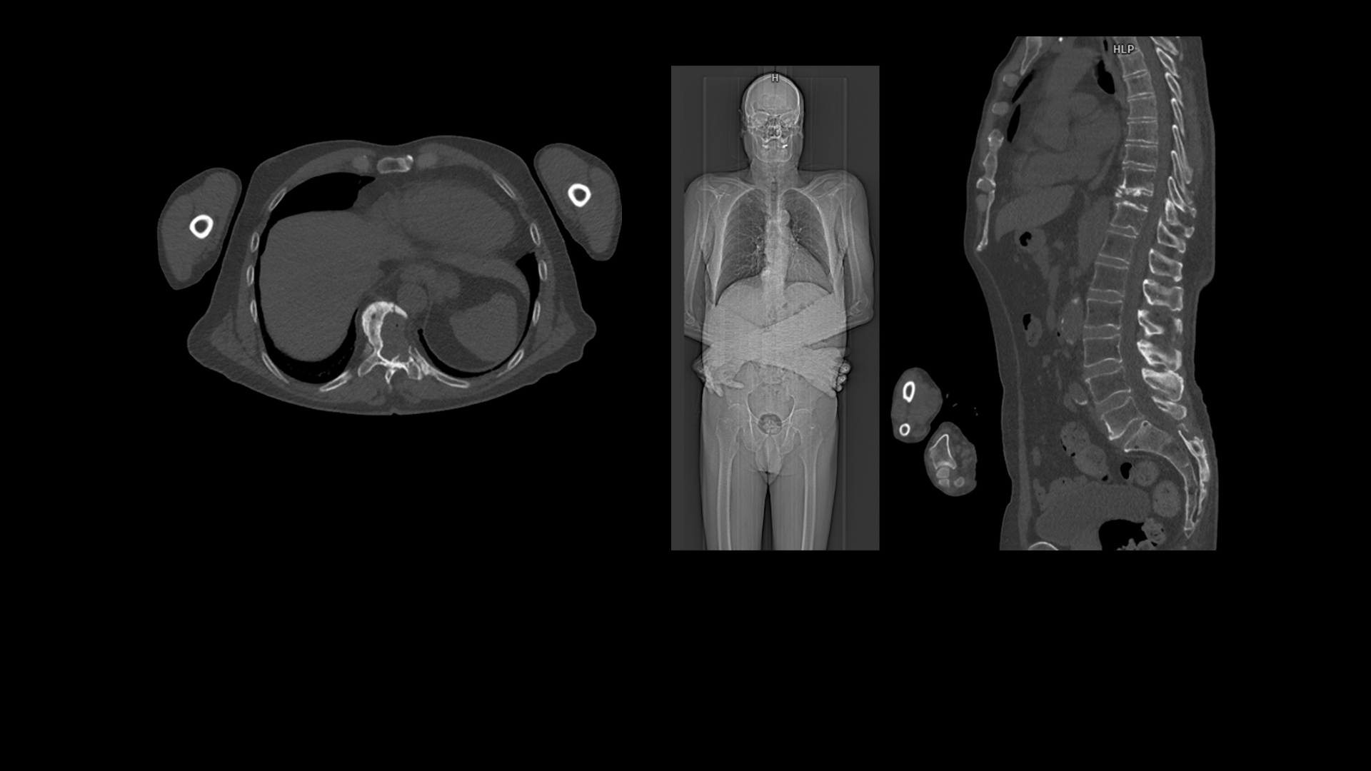 Precision in oncological imaging - Siemens Healthineers Polska