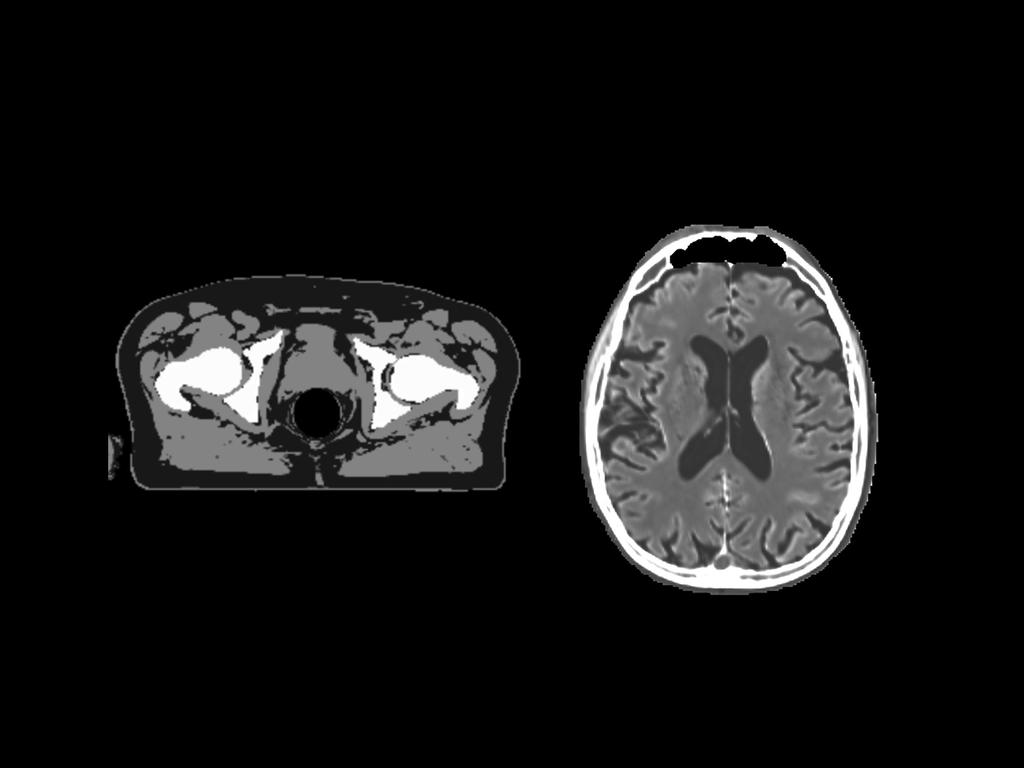 Clinical Imaging Solutions - MRI Applications - Siemens Healthineers