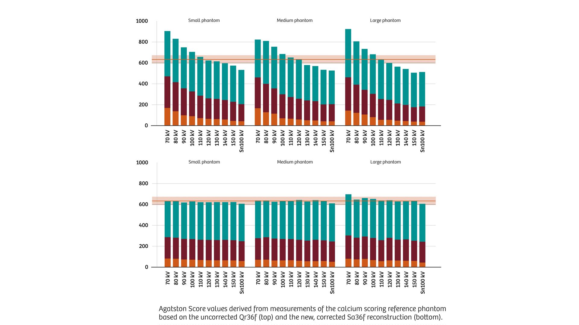 Time to Rethink the Calcium Scoring Workflow