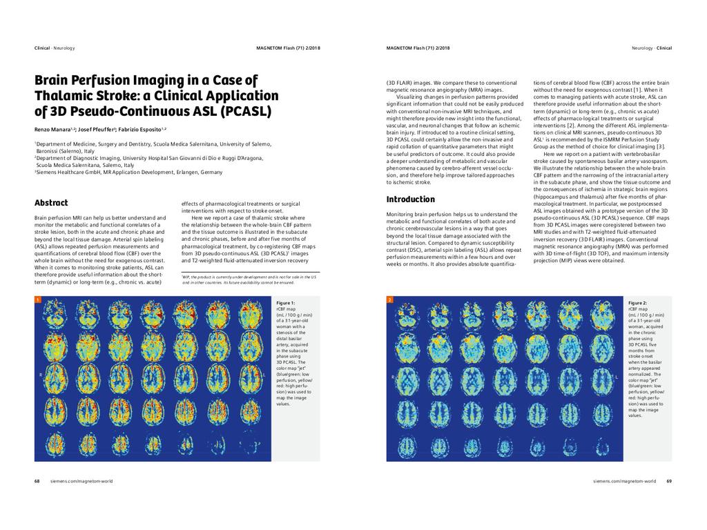 Arterial Spin Labeling