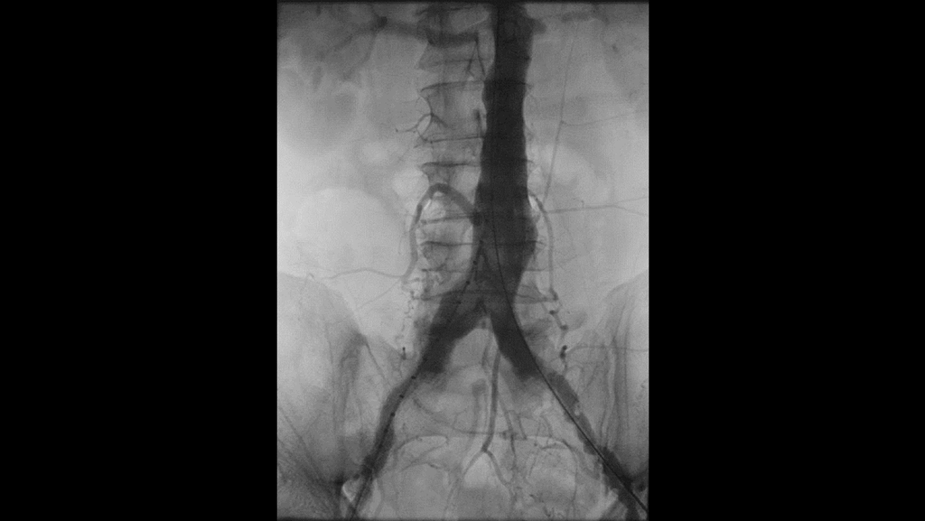 Vascular Surgery - Siemens Healthineers