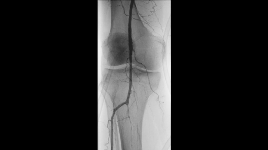 Vascular Surgery - Siemens Healthineers USA