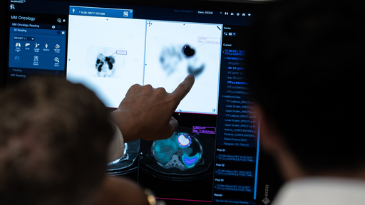 xSPECT Quant - Siemens Healthineers