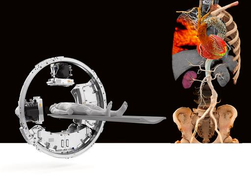 CT Scanners - Siemens Healthineers India