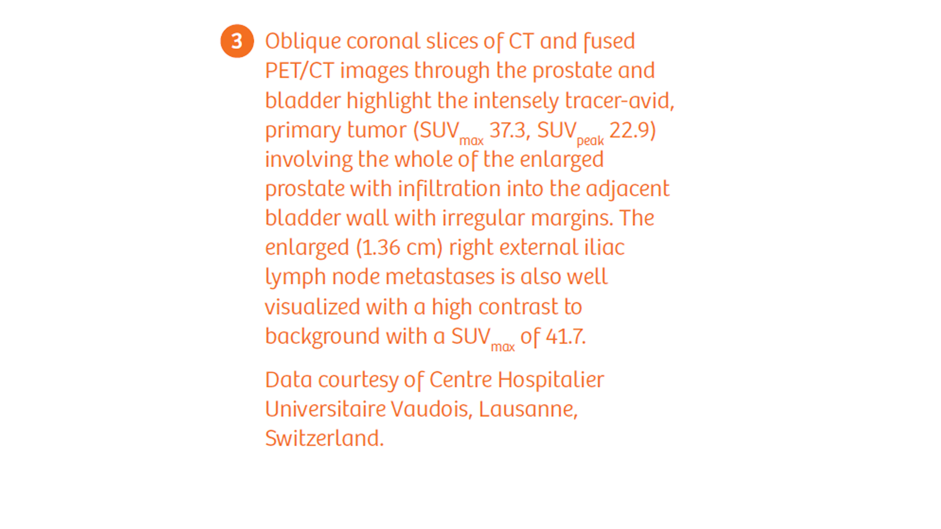 Detection Of Bladder Invasion And Pelvic Lymph Node Metastases In A