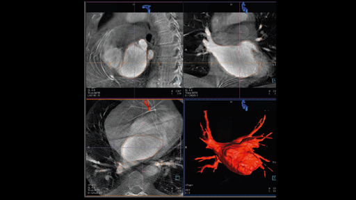The Clinical Pathway - Angiography - Siemens Healthineers USA