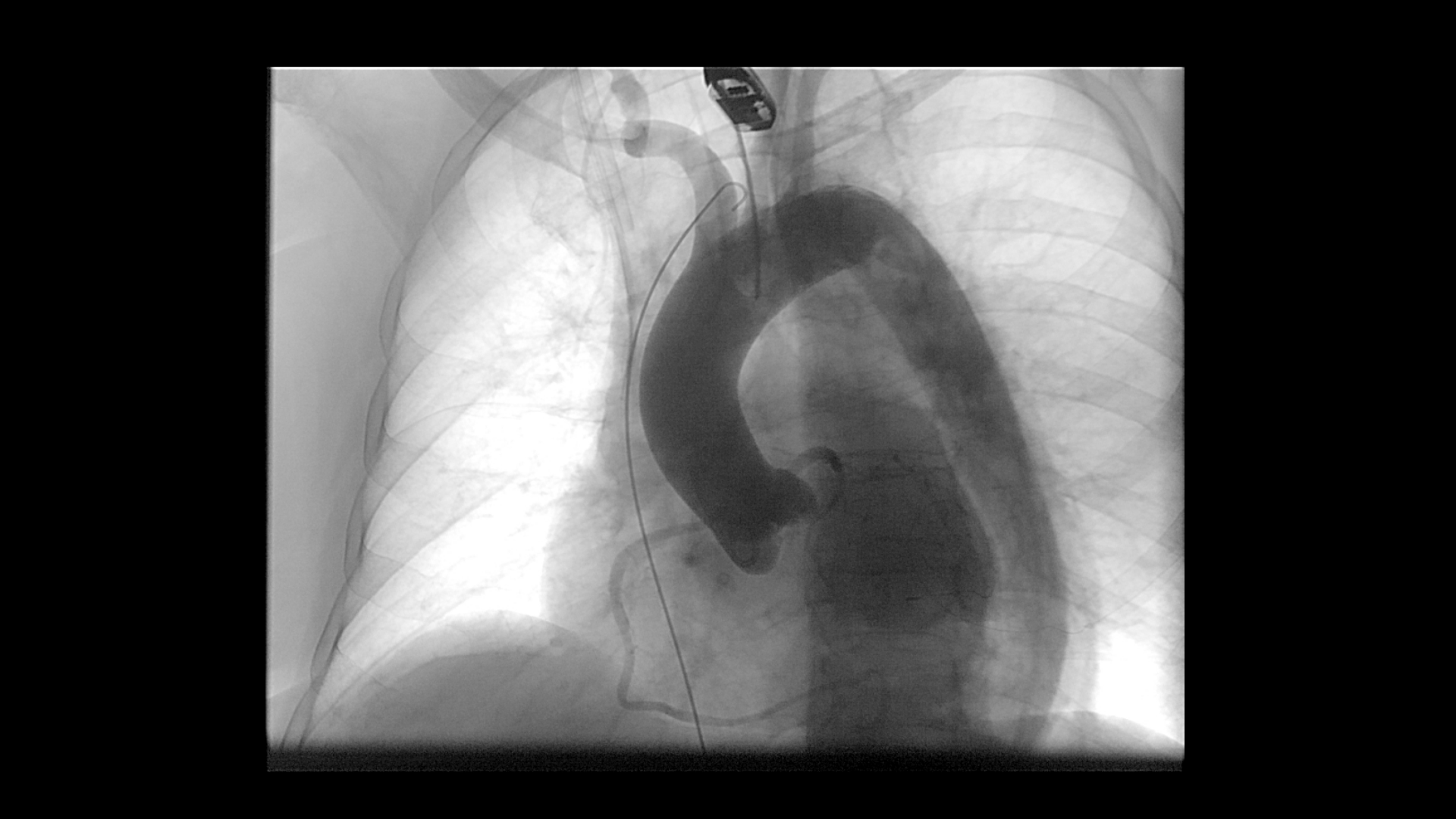 The Clinical Pathway - Angiography - Siemens Healthineers USA