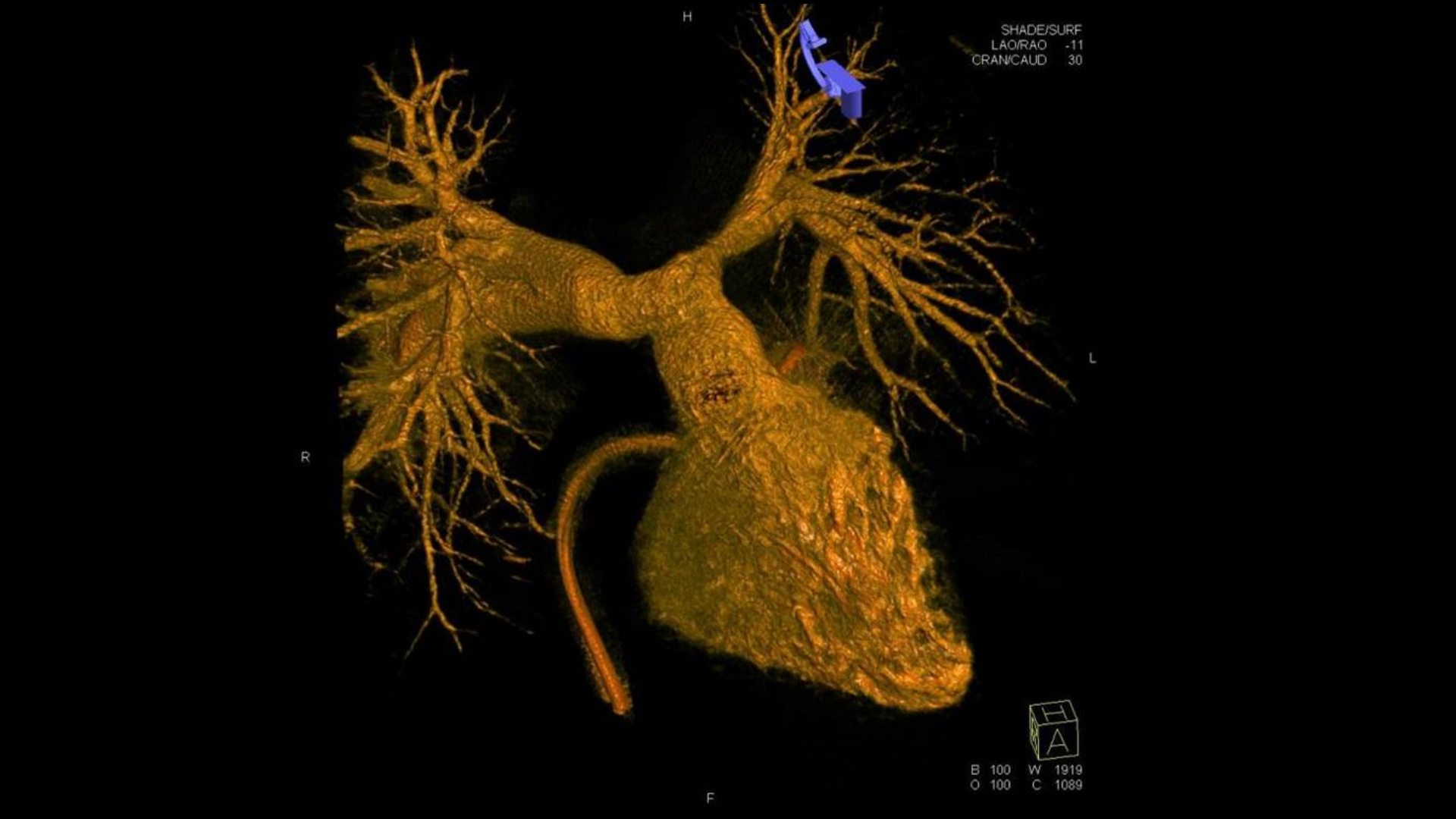 The Clinical Pathway - Angiography - Siemens Healthineers USA
