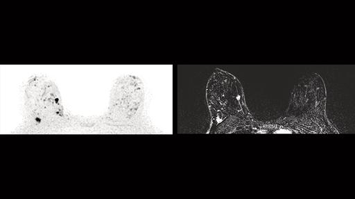 Zooming in on AI-Based Image Interpretation - Siemens Healthineers USA