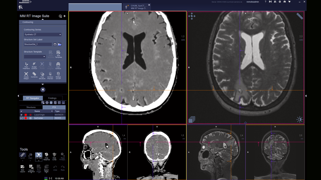 syngo.via RT Image Suite