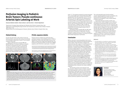 Arterial Spin Labeling