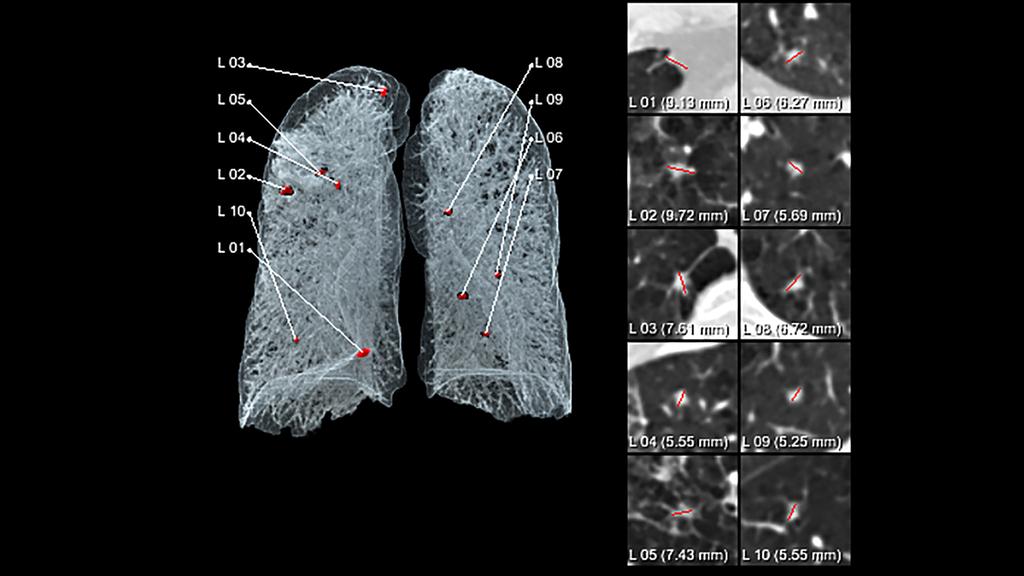 How Your AI-Rad Companion Will Support Thoracic Image Examinations ...