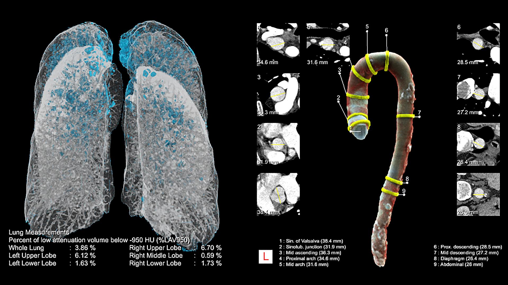 How Your AI-Rad Companion Will Support Thoracic Image Examinations ...