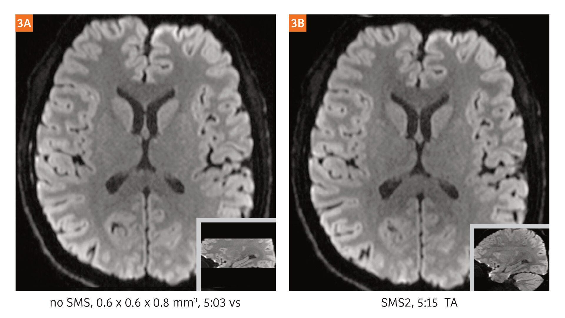 Simultaneous Multi-Slice – a Concise Review Covering Major Applications ...