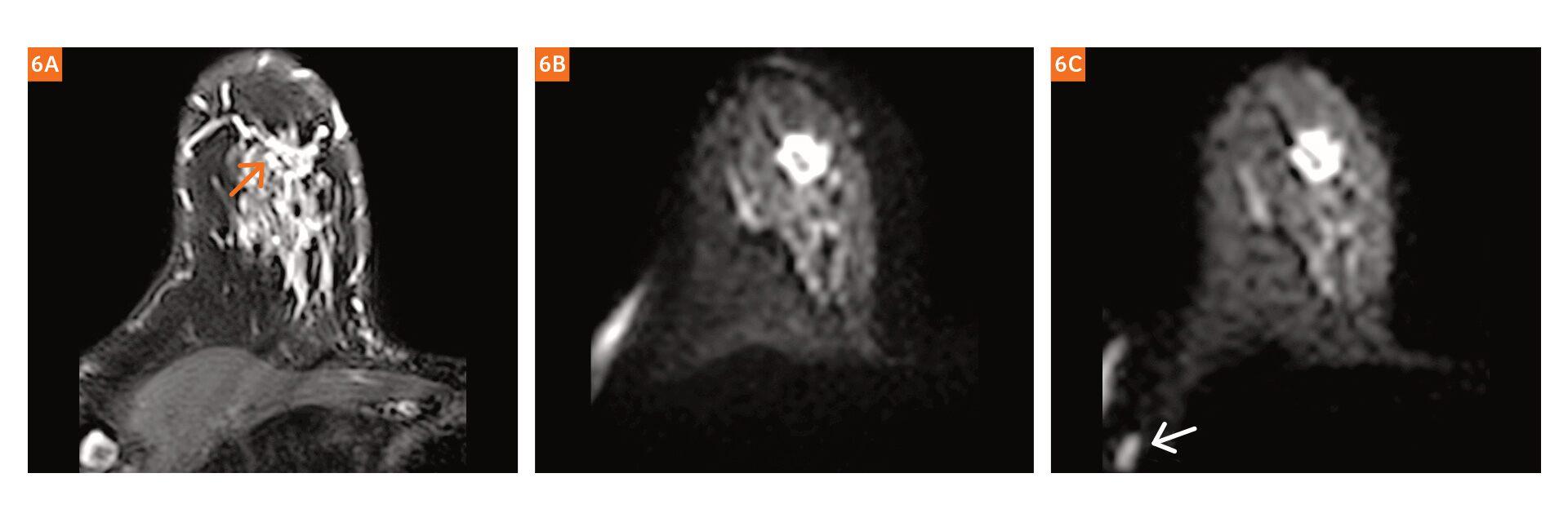 Simultaneous Multi-Slice – a Concise Review Covering Major Applications ...