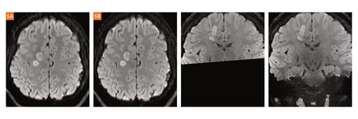 Simultaneous Multi-Slice – a Concise Review Covering Major Applications ...