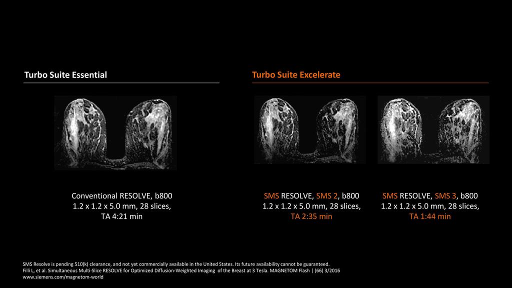 MAGNETOM Vida Fit - Siemens Healthineers USA