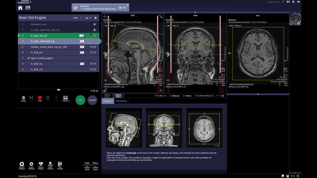 Brain Dot Engine Siemens Healthineers Italia