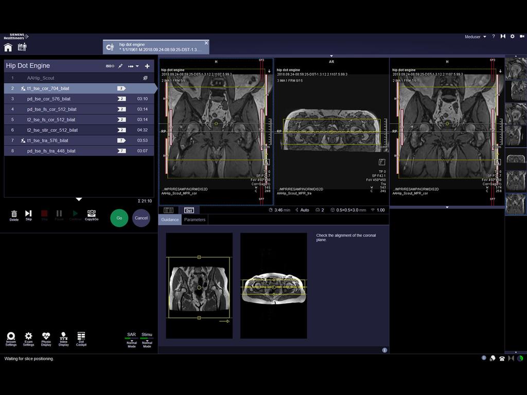 Les artefacts en IRM - Siemens Healthineers France