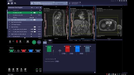 Magnetic Resonance Imaging - Clinical Software Applications - Siemens ...