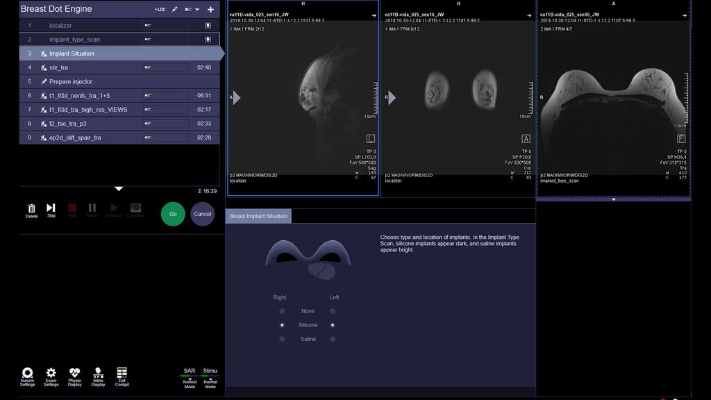 Breast Dot Engine Siemens Healthineers Italia