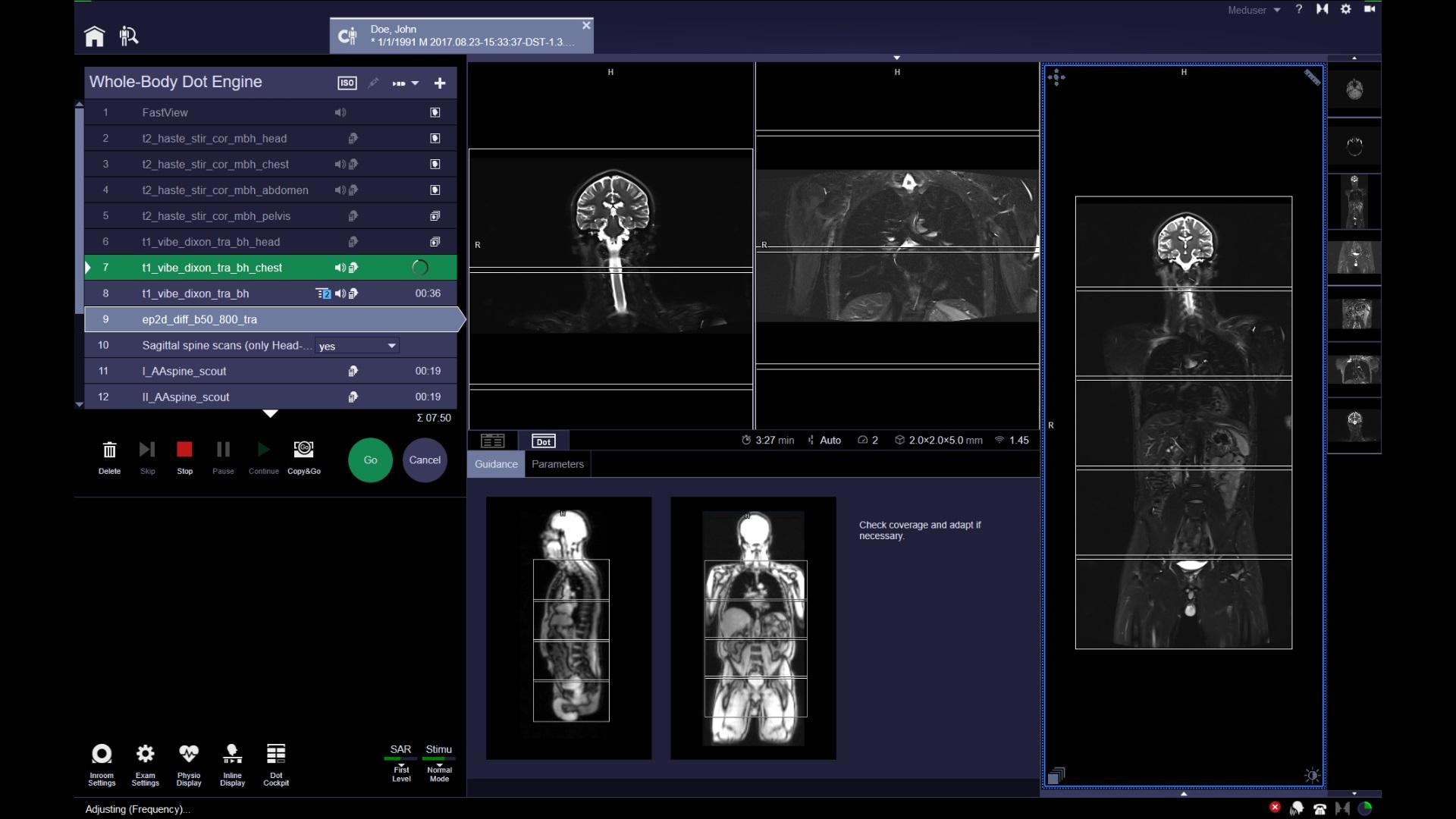Whole-Body Dot Engine - Siemens Healthineers USA