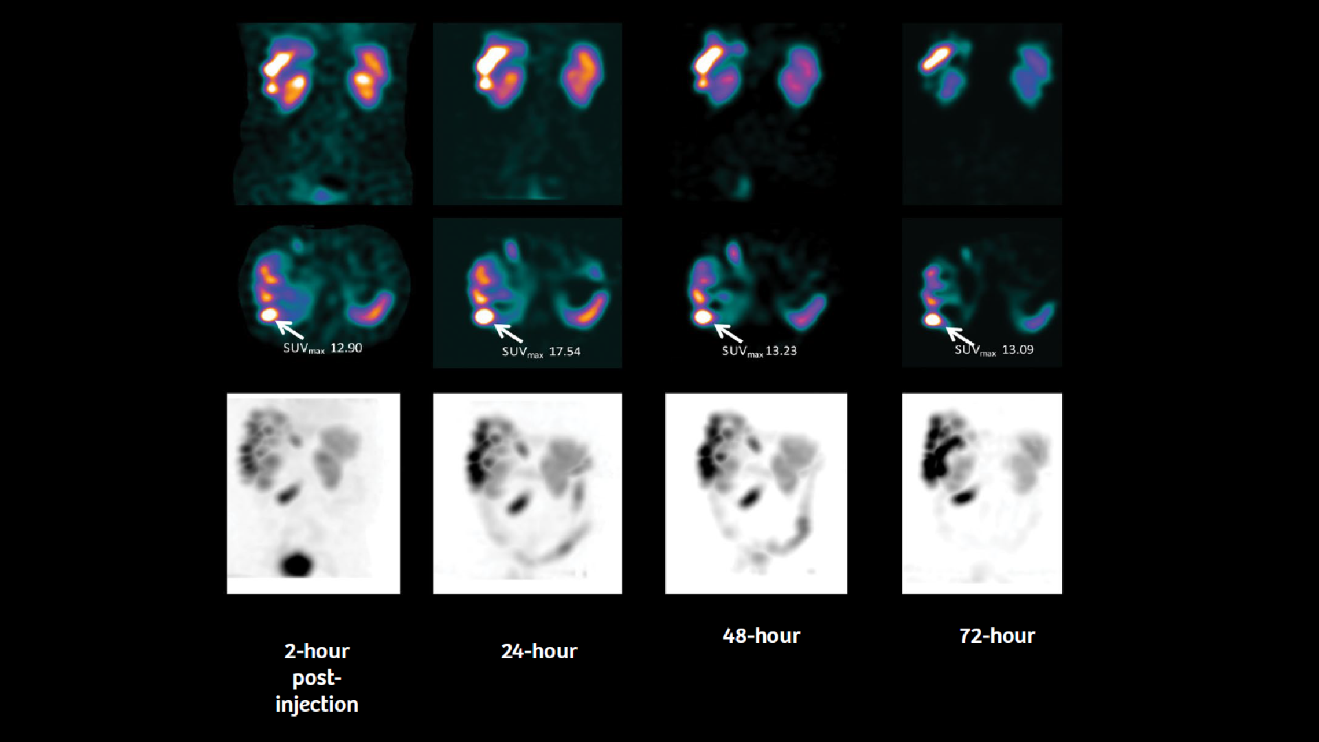 Sequential quantitative SPECT/CT following therapeutic administration ...