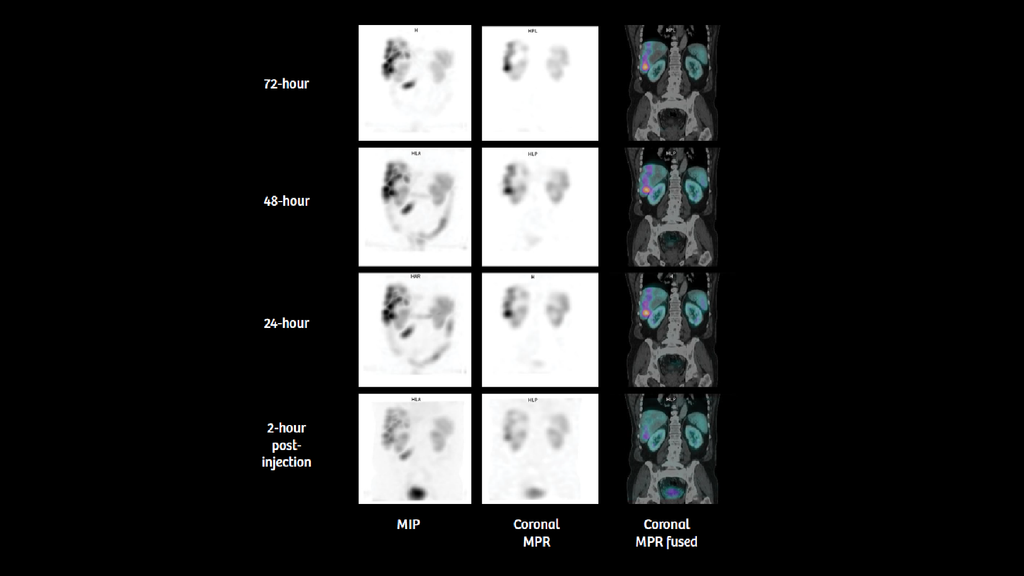 Sequential quantitative SPECT/CT following therapeutic administration ...