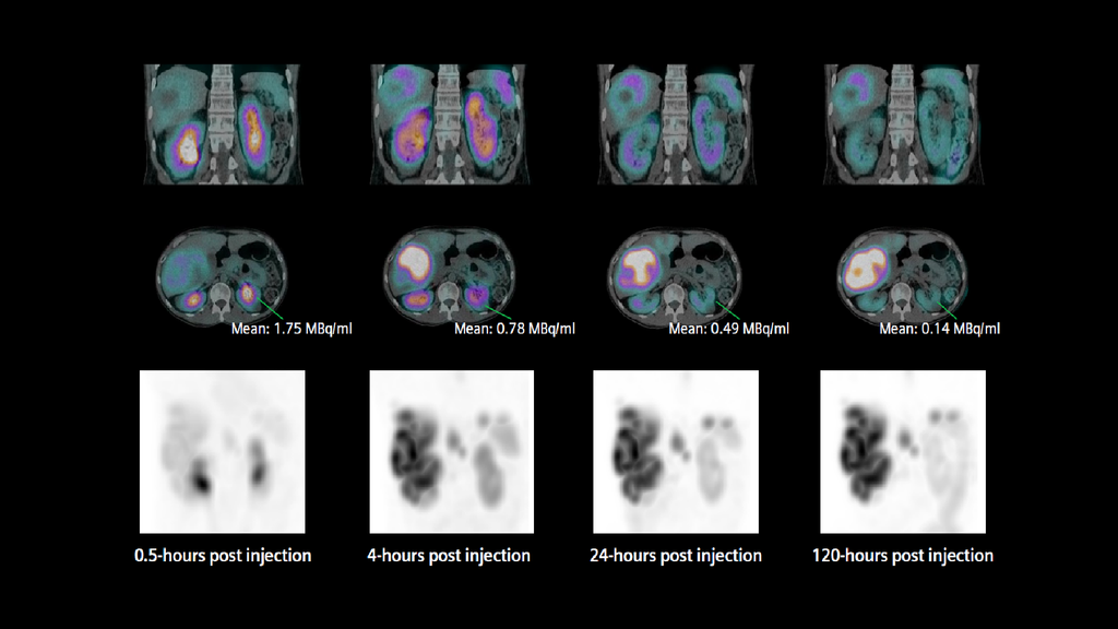 Evaluation of absorbed dose using sequential quantitative SPECT/CT ...