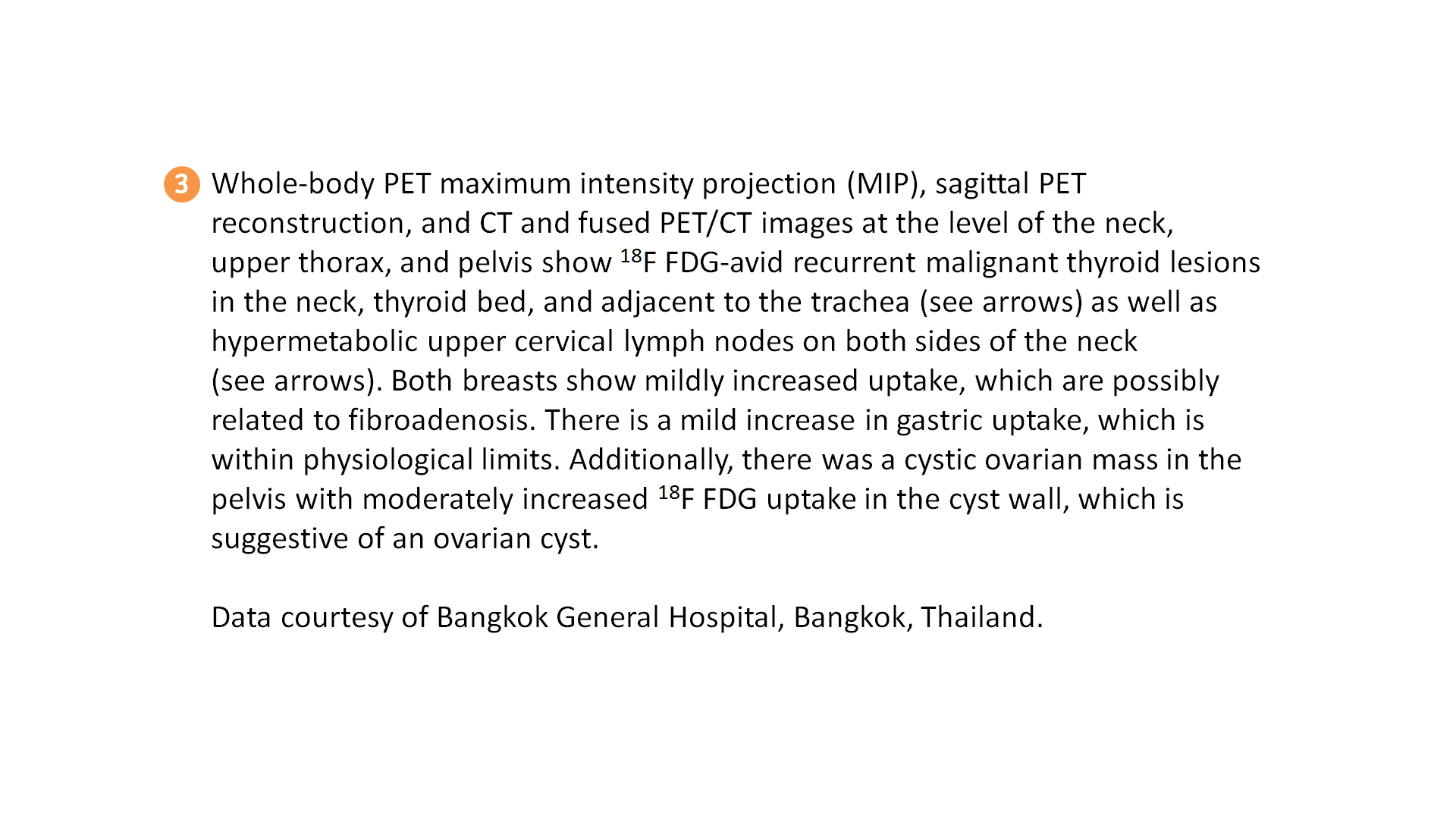 PET/CT detection of Fludeoxyglucose F 18 Injection (18F FDG)-avid ...