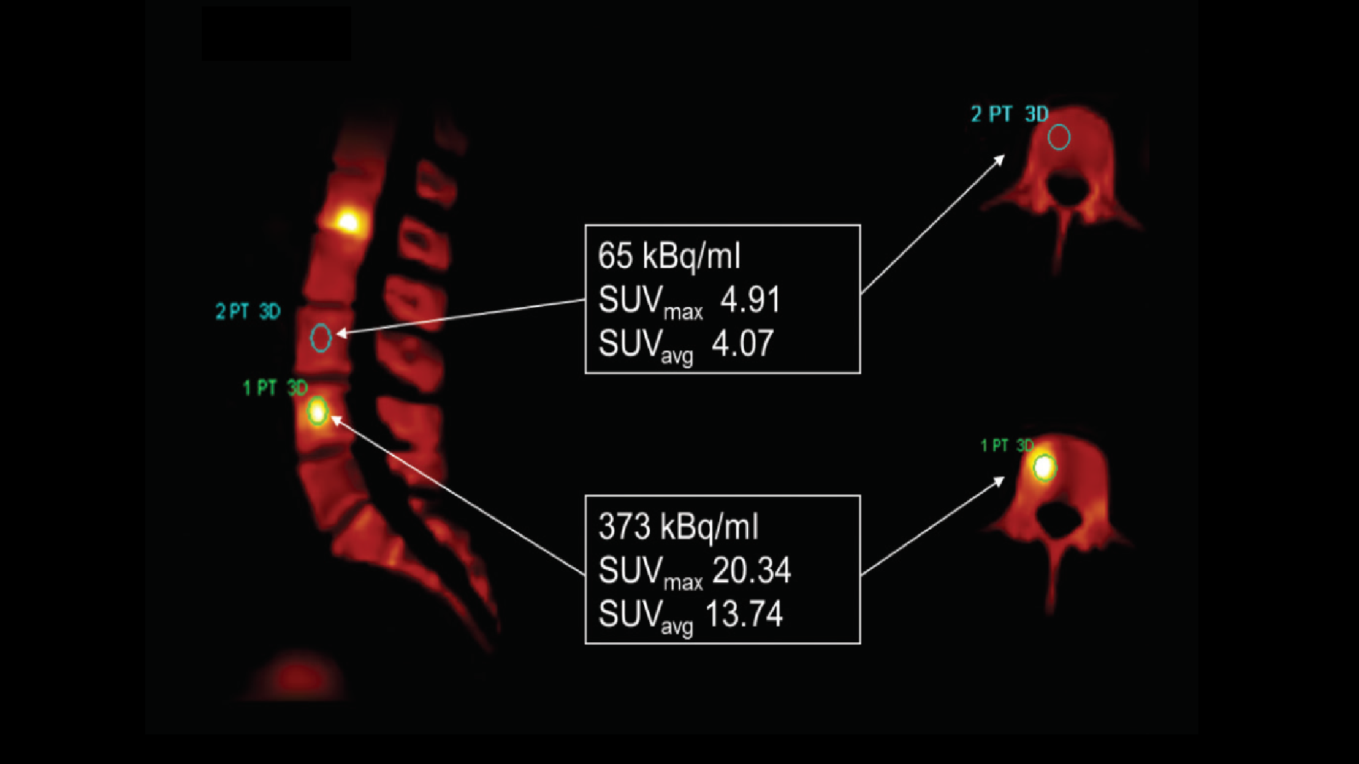 Accurate, Reproducible, And Standardized Quantification - Siemens ...