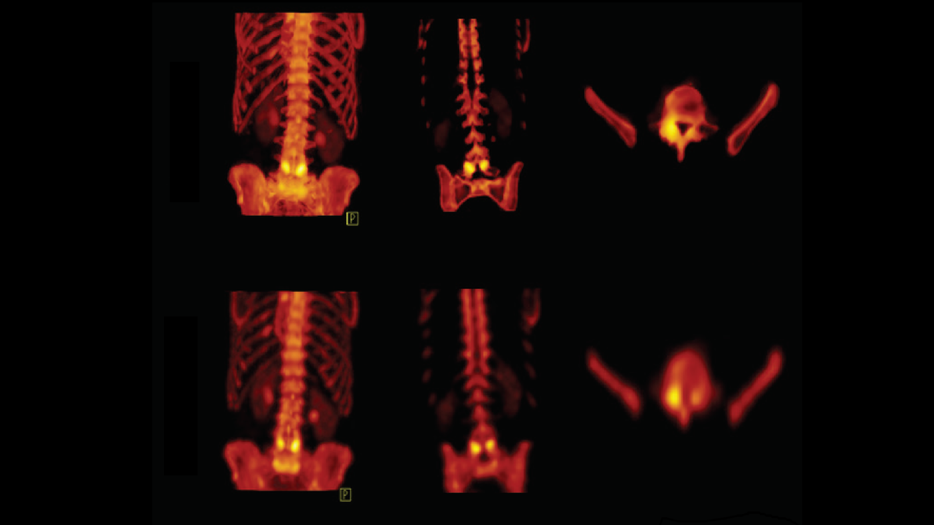 Molecular Imaging White Papers - Siemens Healthineers