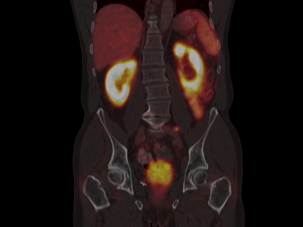 Molecular Imaging Systems