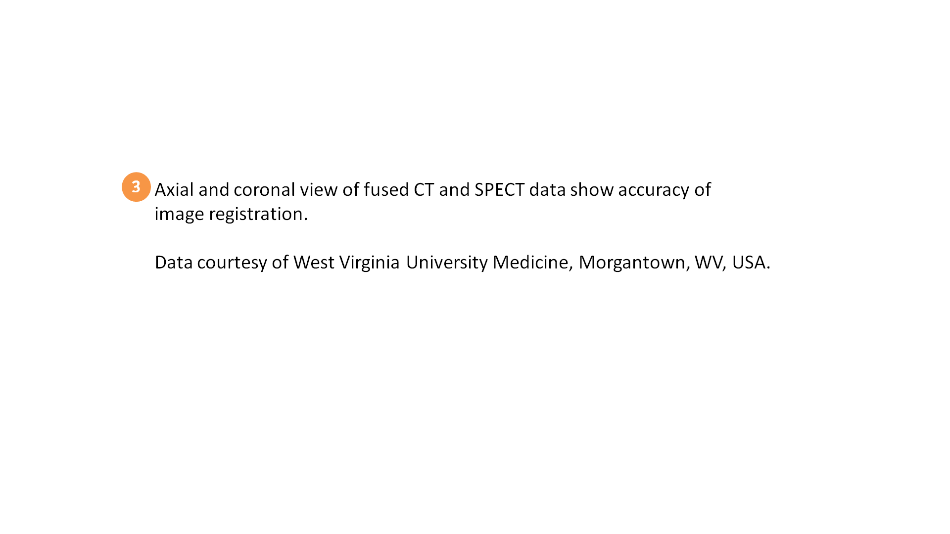 Spectct Overcomes Breast Attenuation Artifact For Improved Specificity
