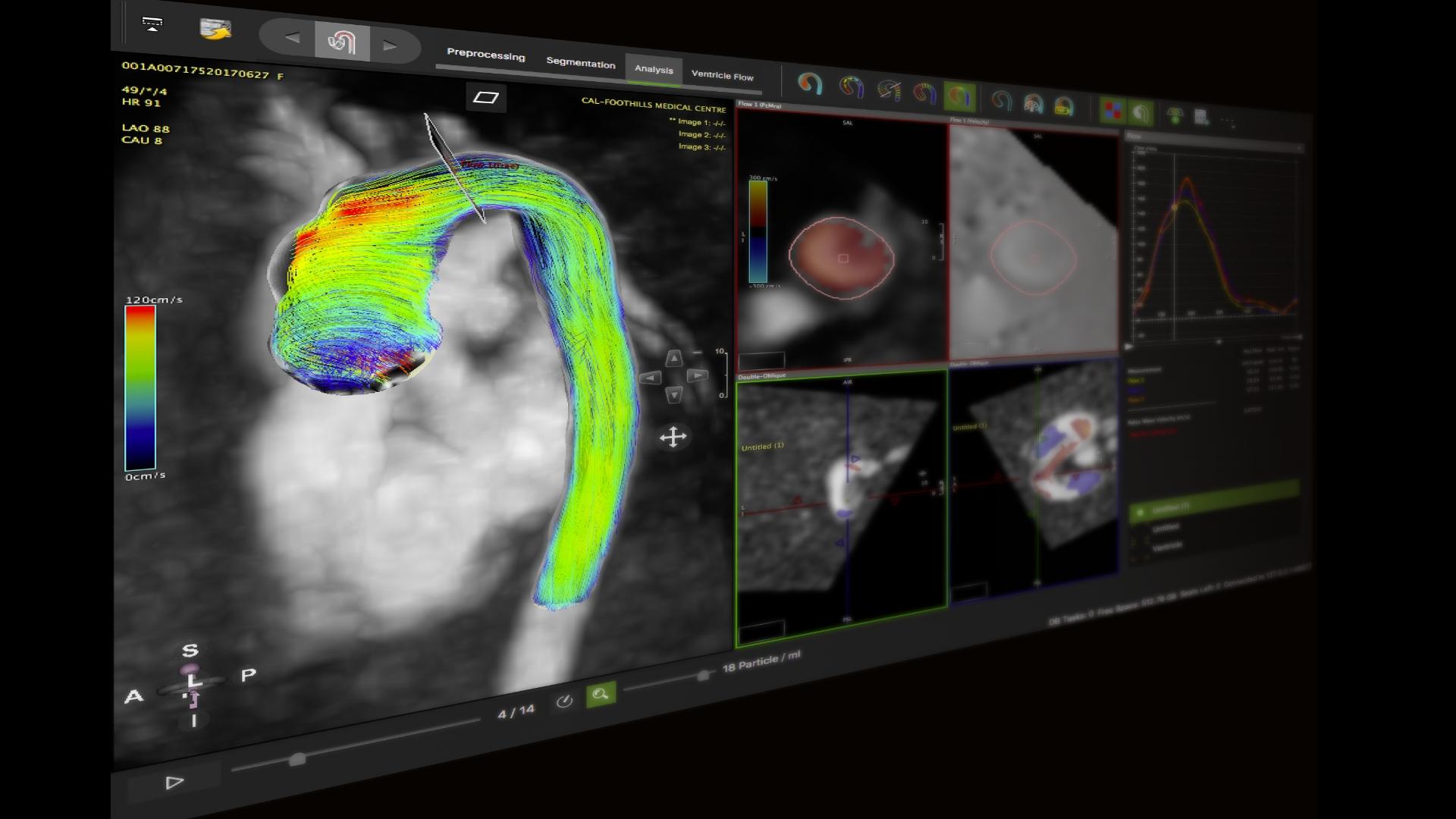 Magnetic Resonance Accessories