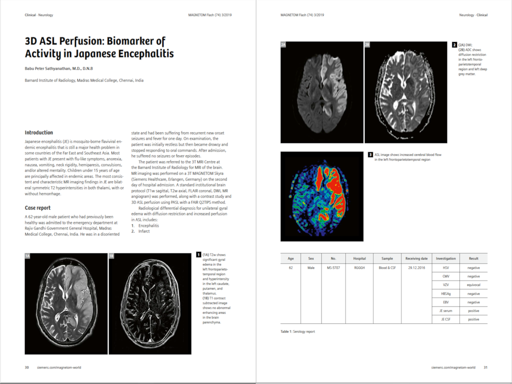 Arterial Spin Labeling