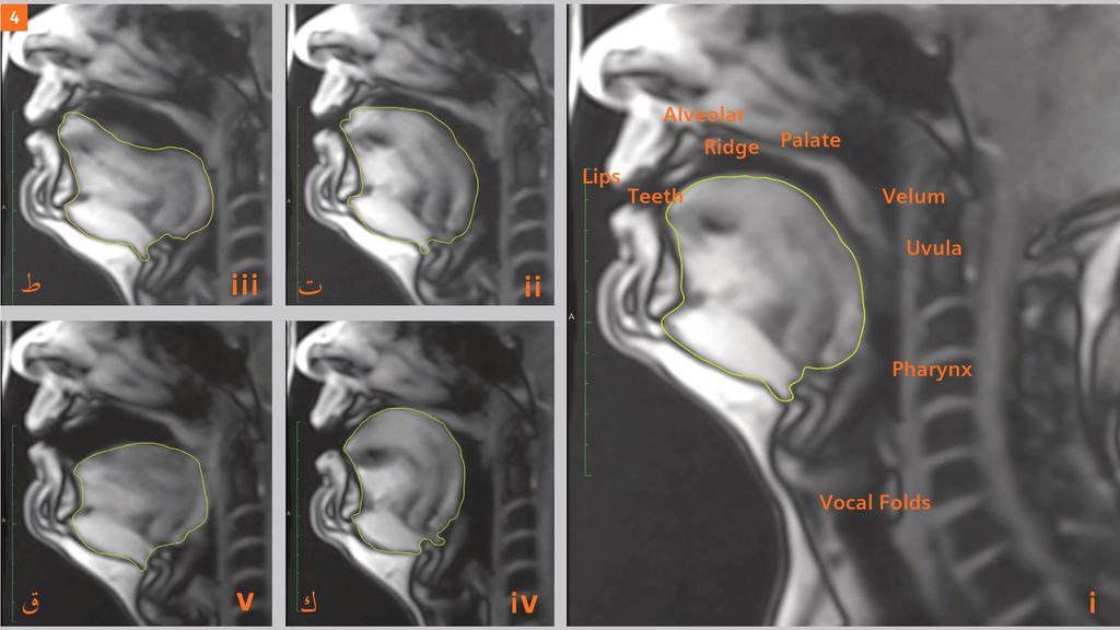 Integrating Multimodal Magnetic Resonance Imaging (MRI) and ...