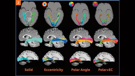 Integrating Multimodal Magnetic Resonance Imaging (MRI) and ...