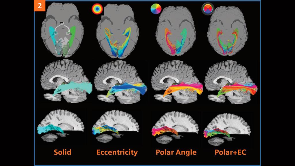 Integrating Multimodal Magnetic Resonance Imaging (MRI) and ...