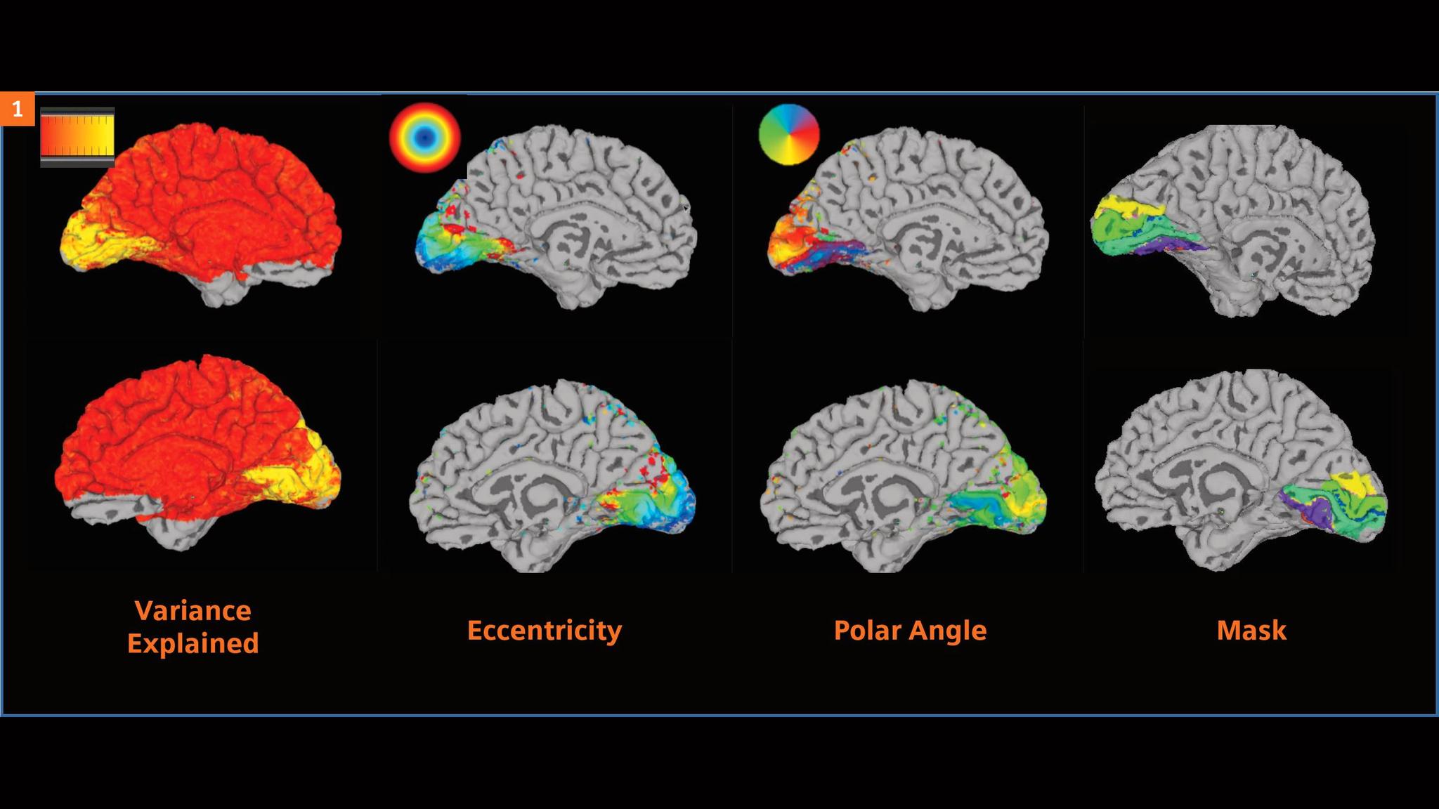 Integrating Multimodal Magnetic Resonance Imaging (MRI) and Magnetoencephalography (MEG) to ...