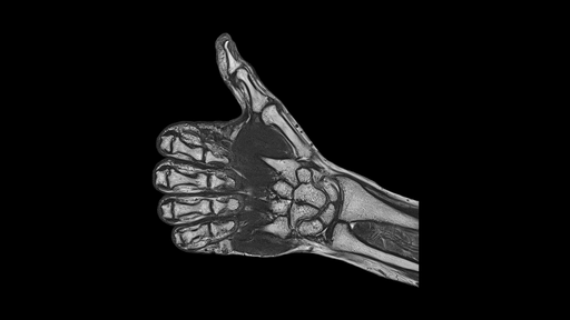 Musculoskeletal Imaging - Siemens Healthineers